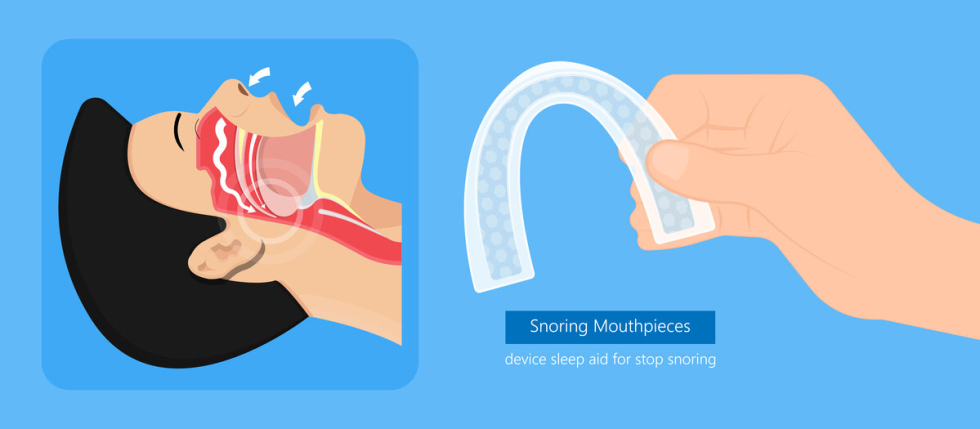 Mouth Guard for Snoring: A Complete Guide